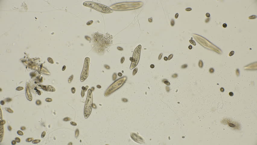 Colony of Ciliates Coleps, Prey Stock Footage Video (100% Royalty-free ...
