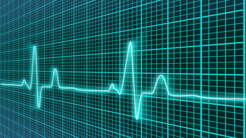 Looped Animated Ecg Electrocardiogram Display. Stock Footage Video (100 ...