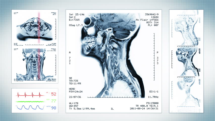 Brain, Knee And Neck MRI Scan. Blue. 3 Videos In 1 File. Loopable ...