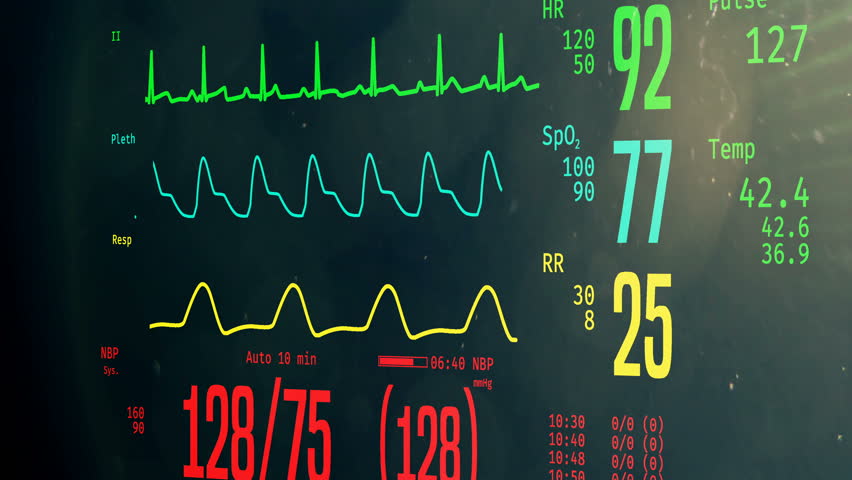 Monitoring Of Patient's Condition, Vital Signs On ICU Monitor In ...