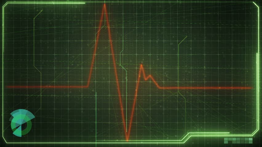 Heart Rate Monitor. Animation of Stock Footage Video (100% Royalty-free ...