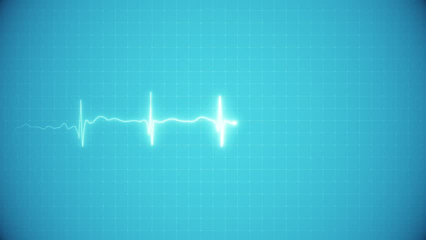 Animation Of Schematic Diagram Of Normal Sinus Rhythm For A Human Heart ...