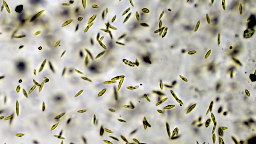 Stock video of algae microscope view (hd). microscopic algae | 2147582 ...