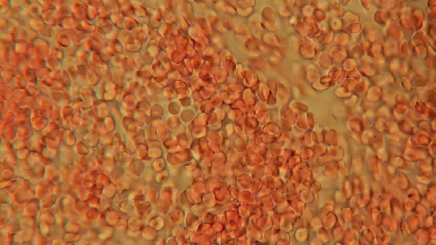 Human Blood 600x (HD). Microscope 600x View Of Red Blood Cells Moving ...