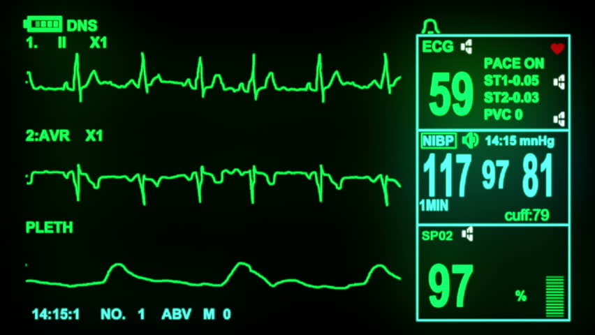 Hospital Heart Rate Monitor Screen