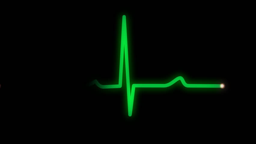 Heart Beat Line Stock Footage Video | Shutterstock