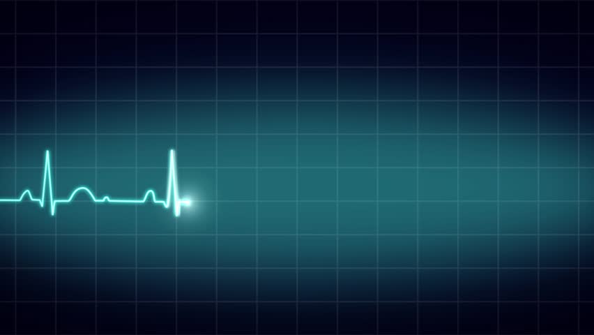 EKG 001: An Electrocardiogram Heart Monitor Pulses On A Blue Grid (Loop ...