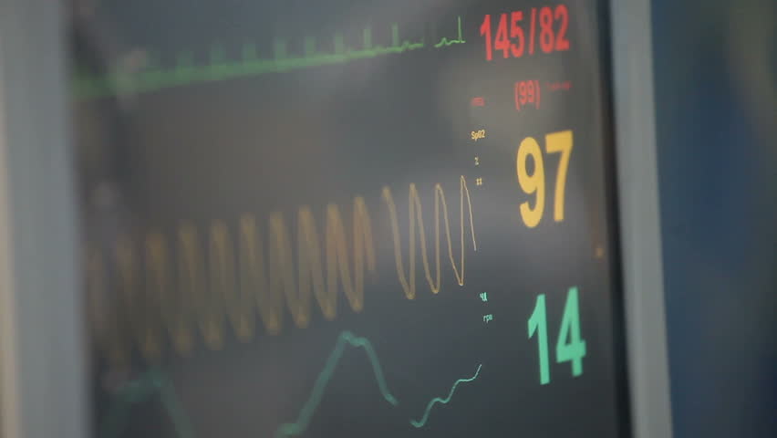 Stock video of the monitor of life support device | 8851792 | Shutterstock