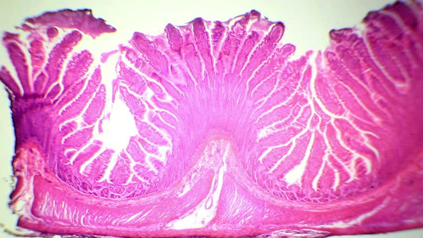 ?ross-section Of The Small Intestine Under The Microscope (Small ...